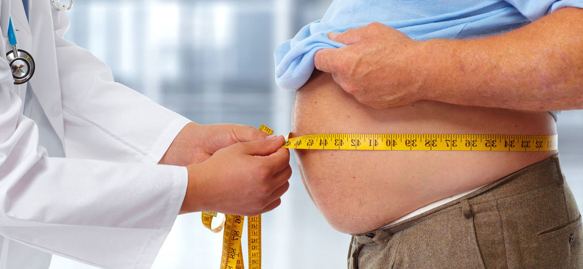 ICD 10 Codes For Obesity Causes And Treatment For Obesity DocCharge ICD 10 Codes For Obesity Causes And Treatment For Obesity DocCharge